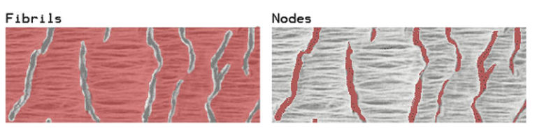ePTFE Porosity : How it is created, how it affects the functional ...